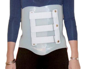 Boston Overlap Brace - A Guide for Patients - Oapl